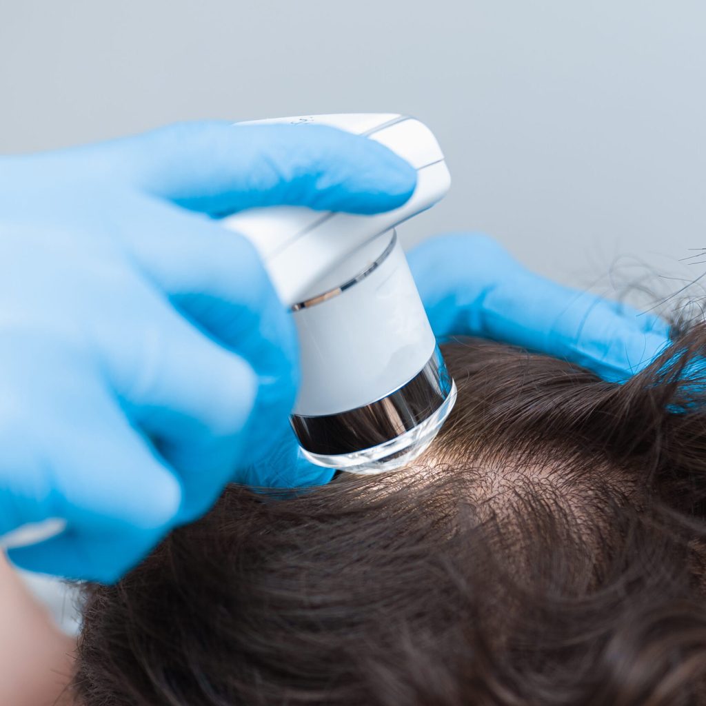 Dr. Ronaldo Borges – Especialista em Transplante Capilar FUE no Rio de Janeiro.